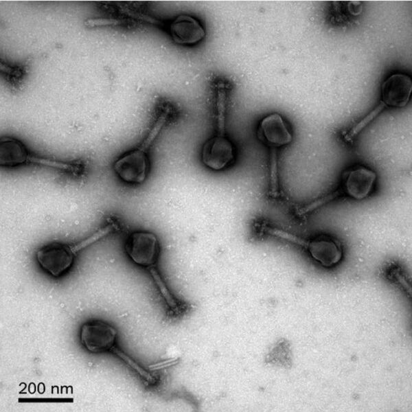Understanding Jumbo Phage Viruses Dr Steven Novella Neurologist